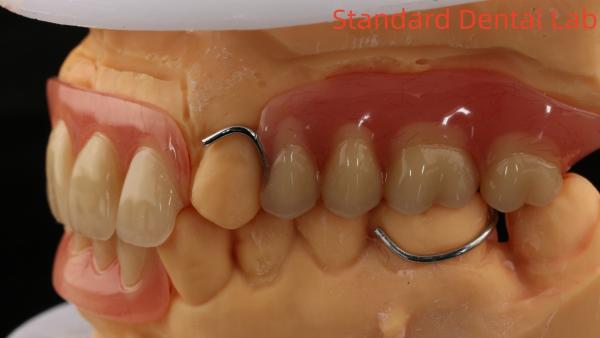 Quality Heat Cured Ivoclar Partial Acrylic Denture Dental Lab High Accuracy with 3D for sale