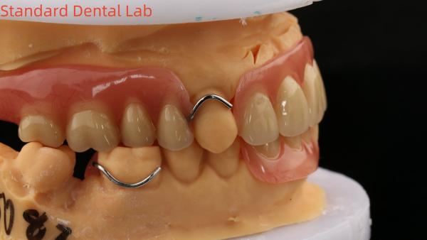 Quality Heat Cured Ivoclar Partial Acrylic Denture Dental Lab High Accuracy with 3D for sale