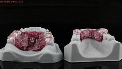 China Teeth Expansion And Distalization Adjusting Expander In Mouth Orthodontist Palate Expander for sale