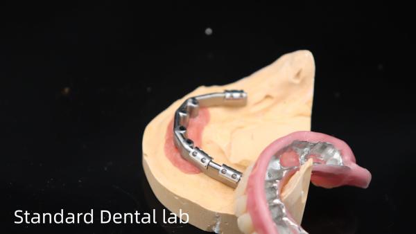 Quality Titanium Implant Supported Dentures Precise Ivoclar Denture Over Implants for sale