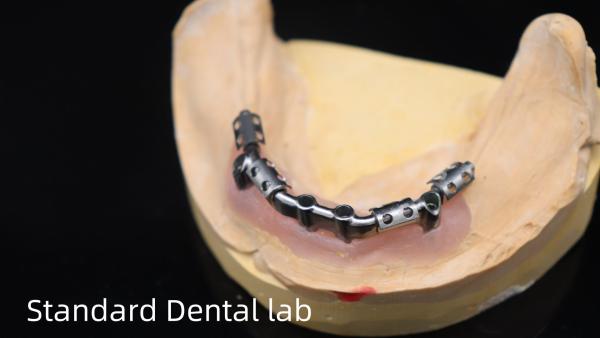 Quality Titanium Implant Supported Dentures Precise Ivoclar Denture Over Implants for sale