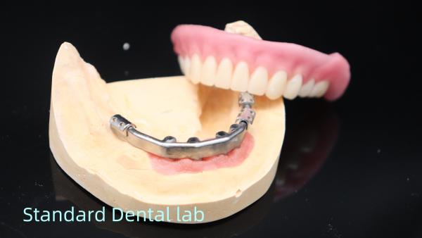 Quality Titanium Implant Supported Dentures Precise Ivoclar Denture Over Implants for sale