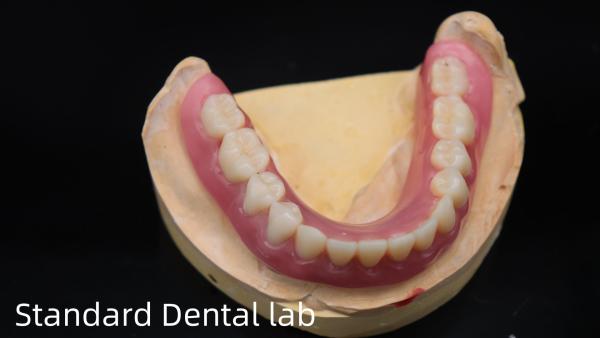 Quality Titanium Implant Supported Dentures Precise Ivoclar Denture Over Implants for sale