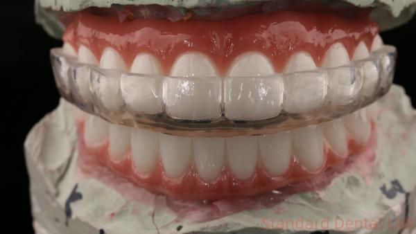 Quality Hard & Soft Night Guard Dental Mouth Guard Hard Soft Night Guard Professional for sale