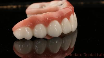 Cina Corone dentale di zirconia di alta qualità e impianto All On Four Six Full Arch / Laboratorio dentale in Cina in vendita
