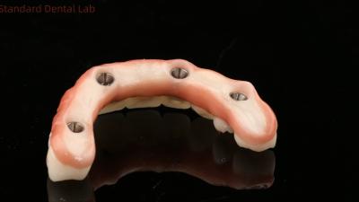 Cina Corone dentale di zirconia di alta qualità e impianto All On Four Six Full Arch / Laboratorio dentale in Cina in vendita