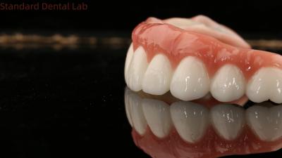Cina Corone dentale di zirconia di alta qualità e impianto All On Four Six Full Arch / Laboratorio dentale in Cina in vendita