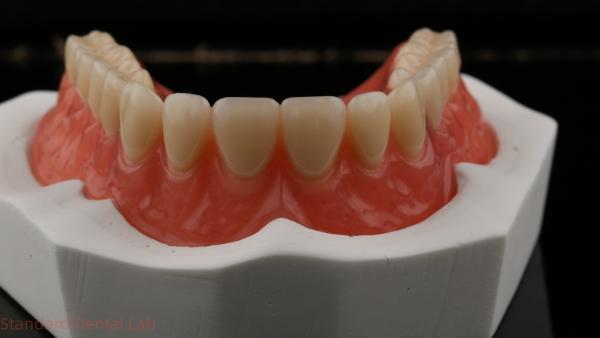 Quality Dentsply Lucitone 199 Acrylic Denture For Full Arch Natural Look for sale