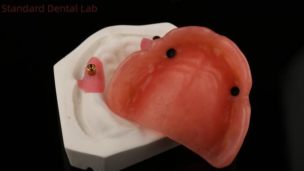 Quality Dentsply Lucitone 199 Acrylic Denture For Full Arch Natural Look for sale