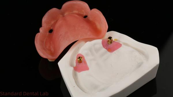 Quality Dentsply Lucitone 199 Acrylic Denture For Full Arch Natural Look for sale