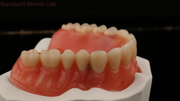 Quality Dentsply Lucitone 199 Acrylic Denture For Full Arch Natural Look for sale