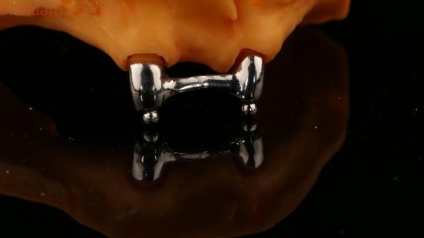 Quality Ivoclar Digital Dental Implant Bar Denture with Attachments , Full Acrylic for sale
