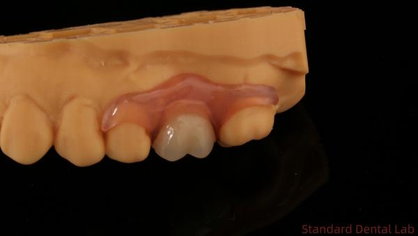 Quality Dental TCS Valplast Flexible Partial Dentures Nesbit Valplast Finish China for sale