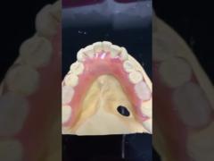 3D Print Model High Esthetics Dental TCS Valplast Flexible Partial Dentures Dental Lab