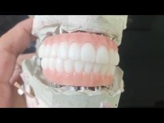 Porcelain All On Four Zirconia Bridge High Esthetics Dental Implant Bridge