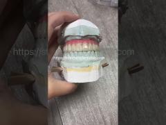 Professional High Esthetics Porcelain All On 4 Zirconia Bridge Dental Implants