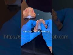 Clear framework Acrylic Metal Partial Denture Frameworks High Esthetics China dental lab