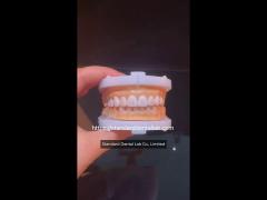 high esthetics white dental crown diagnostic wax up customized china dental lab