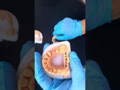 Volledige contour Zirconia kroon snelle omkering voor precieze en esthetische pasvorm in 1 week