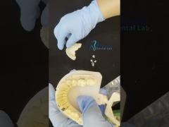 Professional ISO and FDA Approved Yellow Gold Crown for Dental Lab Shipping UPS Or Fedex Production Time 2 Days