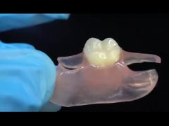Стоматологическая TCS Valplast Гибкие частичные зубные протезы Nesbit Valplast Finish Китайская стоматологическая лаборатория Valplast Clamp