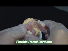 Les dents d'as sont de couleur rose/obscur TCS Valplast Prothèses partielles flexibles pour une esthétique élevée Modèle d'impression 3D dentaire