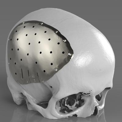 Cina Produzione digitale diretta Metallo stampa 3D Stainless S136 alluminio Alsi10mg parte metallica personalizzata per modelli concettuali in vendita