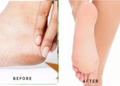 Cina Lenisce la pelle d'alleviamento di riparazione su efficace crema dei prodotti del piede e della mano in vendita