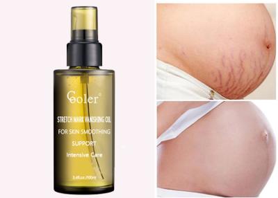 Cina L'età macchia la cura di pelle di maternità delle cicatrici, formula inoffensiva della crema del segno di gravidanza in vendita