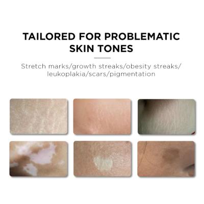 Cina I pigmenti permanenti di trucco del ODM 15ml rimuovono le smagliature in vendita