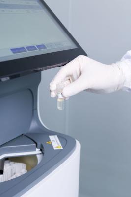 Chine Les marqueurs de tumeur examinent des produits du kit IVD pour le CEA AFP CA125 CA19-9 CA15-3 SCC de 23 sortes à vendre