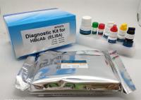 China High Sensitivity HBcAb ELISA Test Kit Easy to Operate 96 Tests for sale