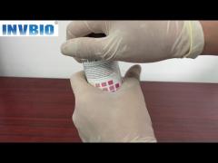 FDA CE Urinalysis Test Strips 11 Parameter 100 Strips/Bottle