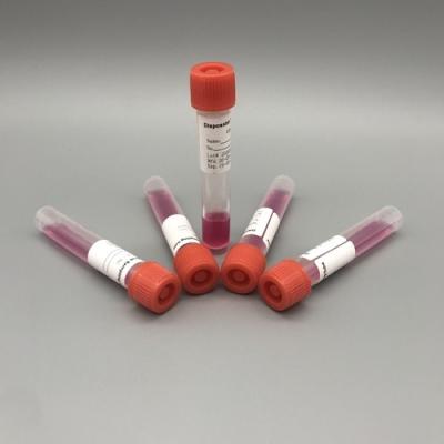 Cina Virus eliminabile di VTM che prova il tampone di Kit Flocked Nylon Nasal Throat in vendita