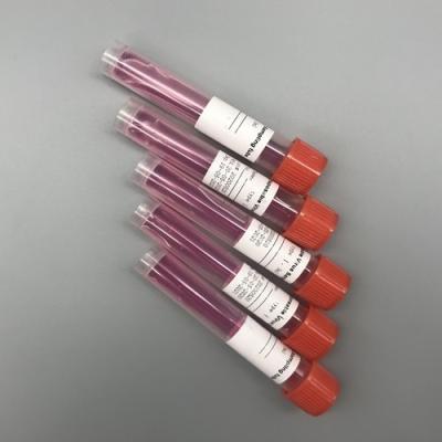 VTM καθολική εξάρτηση δειγματοληψίας μεταφορών μέση προερχόμενη από ιό για PCR τη δοκιμή