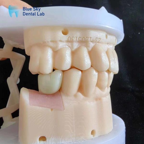 Quality Regular Implant Cases Universal Compatibility Dental Implant Case for sale