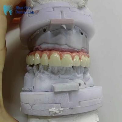 Cina Casse per impianti dentali artificiali personalizzate in vendita