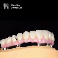 Quality Blue Sky Nature Dental Implant Case Multiple Choices Implant System for sale