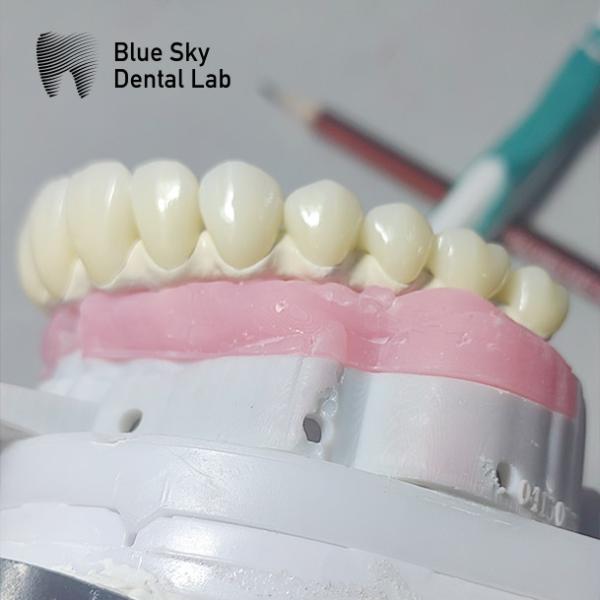 Quality Pure Titanium Malo Implant Bridge Universal Metal Frame Malo Bridge for sale