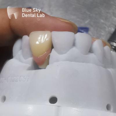 Cina Casse per impianti dentali regolari Compatibilità universale Cassa per impianti dentali in vendita