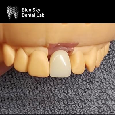 Cina Casse per impianti dentali regolari Compatibilità universale Cassa per impianti dentali in vendita