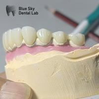 China Implantation Cases for Multiple Implant Systems for sale