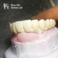 China Implantation Cases for Multiple Implant Systems for sale