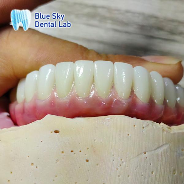 Quality Universal Compatibility Implant Cases Customize Full Mouth Implant Case for sale