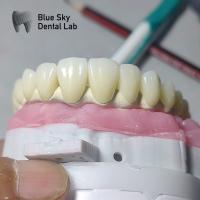 China Universal Dental Implant Case Compatible With Multiple Implant Systems for sale