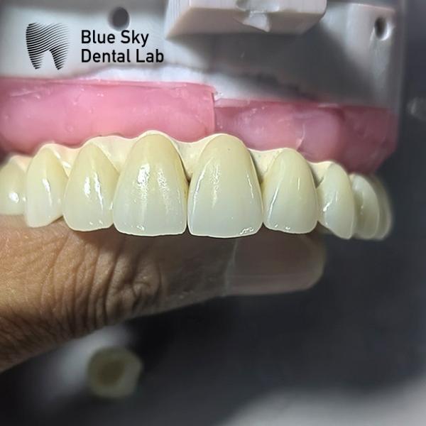 Quality Regular Implanted Device Cases Steam Sterilization Implant Cases for sale