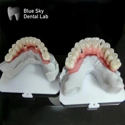 China Blue Sky Implantatie Volle Boog Implantatie Cases Natuur Implantatie Cases Te koop