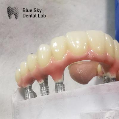China Nature Shape Full Arch Implant Cases Smooth Surface Dental Implant Case for sale