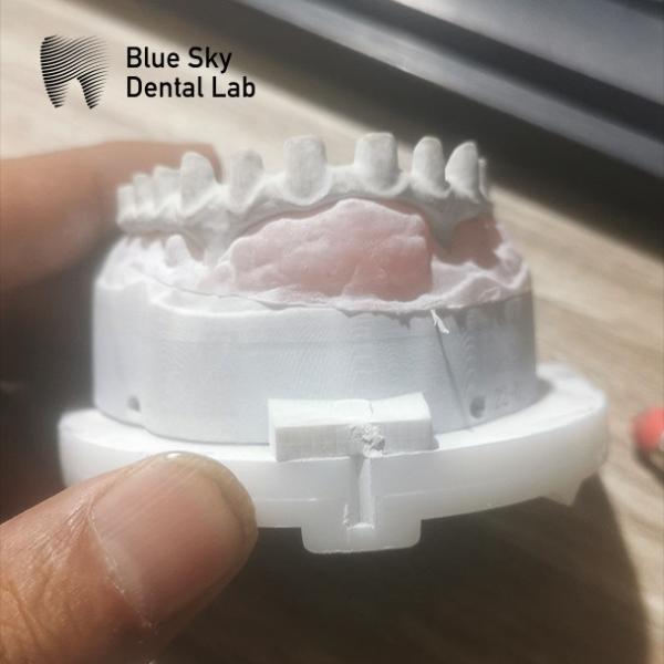 Quality Customizable Industrial Malo Bridge In Silver And Gold Malo Implant Bridge for sale