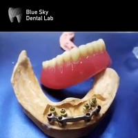 Quality Full Mouth Dental Titanium Bar Accurate Removable Denture Restoration for sale